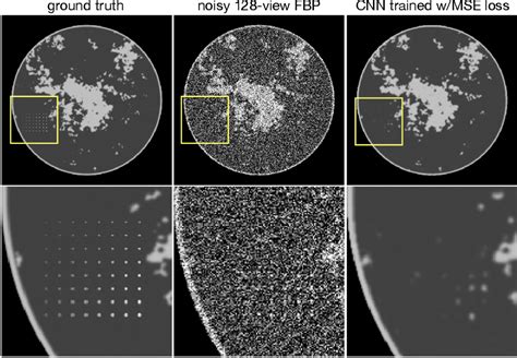 Figure 1 From Enhancing Signal Detectability In Learning Based Ct Reconstruction With A Model