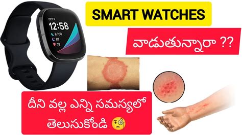 Smart Watches Skin Problems How To Control Skin Diseases In Telugu YouTube