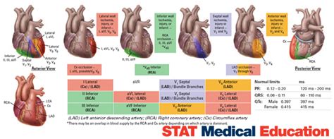 12 Lead And Stemi Placement Cardiac Nursing Ekg Medical Knowledge