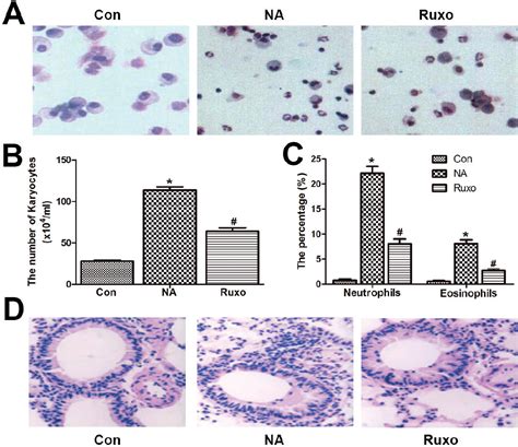 Figure 1 From Jak Stat5 Signaling Pathway Inhibitor Ruxolitinib Reduces Airway Inflammation Of