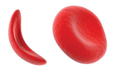 Sickle Cell Gene Detection Edvotek 116 — Stem Reactor Biotechnology