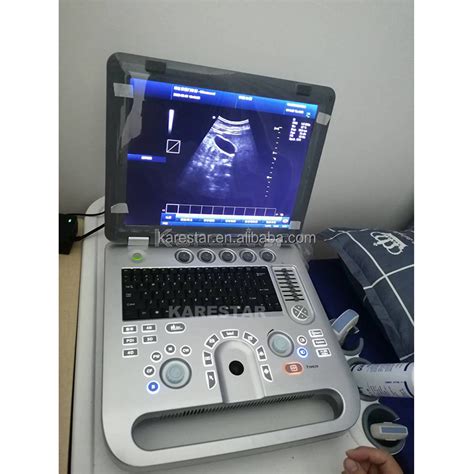 Echocardiography Machine Price 3d 4d Cardiac Echo Karestar Portable Cw Color Doppler Veterinary