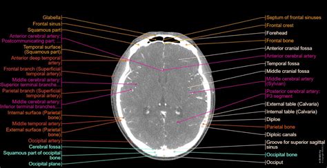 Ct Scan Head Anatomy