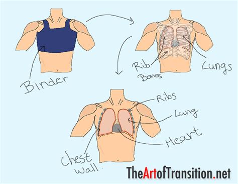 Chest Binding Before And After Lewismendozarings