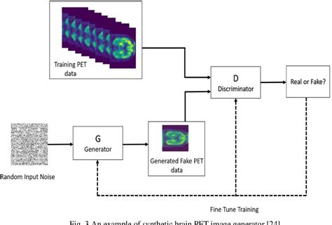 figure 1 from generative adversarial networks for brain images