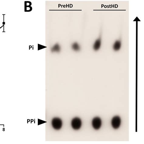 Phosphate Inhibits Pyrophosphate Hydrolysis 32 Pyrophosphate 32 Ppi