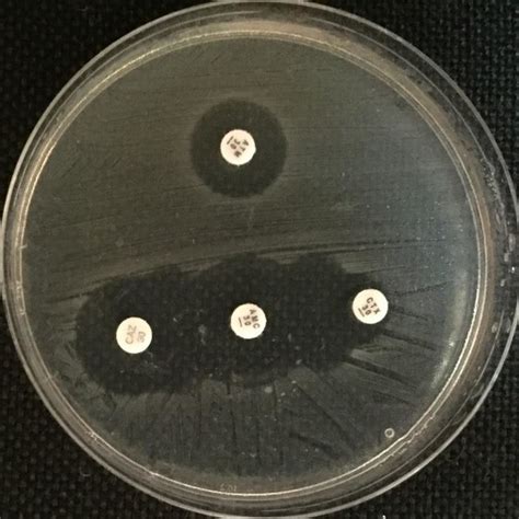 Age Groups And Sex Distribution Of Patients With Esbl Positive E Coli Download Scientific