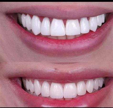 သွားနှင့်ခံတွင်းကျန်းမာရေးဆွေးနွေးကြမယ်