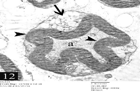 A Photomicrograph Of An Ultrathin Section Of Sciatic Nerve Of