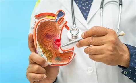 Peptic Ulcer Disease Dr Sacha Sidani