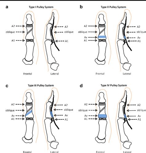 Mr Imaging Findings Of Trigger Thumb Semantic Scholar