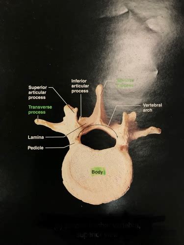 Anatomy Exam 3 Vertebral Column Flashcards Quizlet