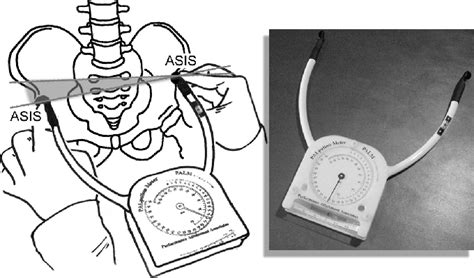 Left Schematic Drawing Of The Employed Method Of Pelvic Asymmetry