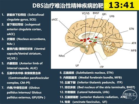 王学廉教授：dbs治疗难治性精神疾病的进展 脑医汇