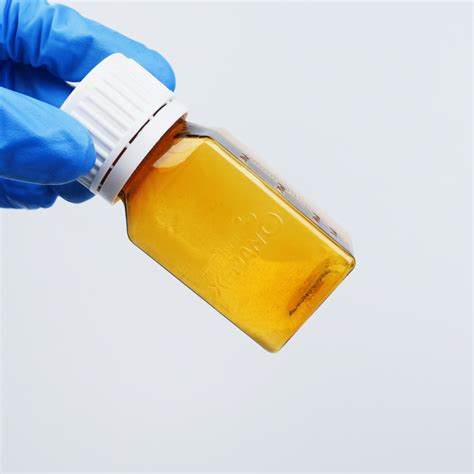 单分散介孔二氧化硅纳米微球星状 介孔二氧化硅 江苏先丰纳米材料科技有限公司 高品质石墨烯 黑磷 碳纳米管 等纳米材料制造商和技术服务商