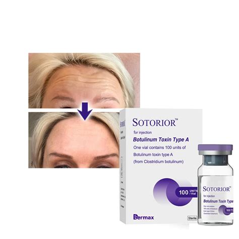 Botulax VS Nabota VS Innotox VS Rentox Dermax Aesthetic