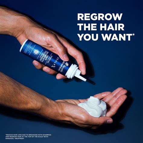 HEAD SHOULDERS SCALP X 5 MINOXIDIL FOR MEN1 CAN IMPORTED FROM USA Shopee Philippines