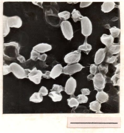 Scanning Electron Microscopy Sem Showing Spores And Parasporal