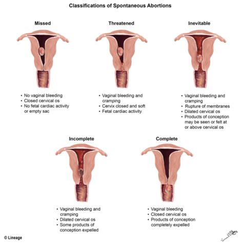 Obgyn Eor Flashcards Quizlet