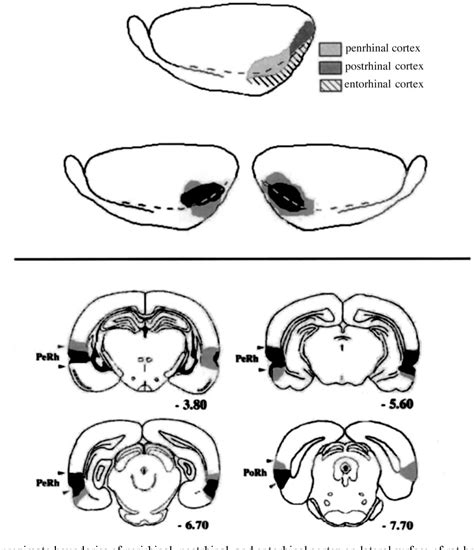 Figure 1 From Dissociation In Retrograde Memory For Object Discriminations And Object