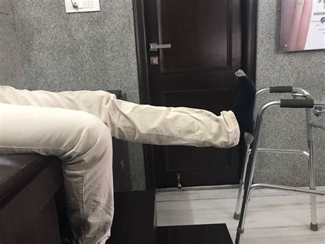 Arthroscopic Pcl Reconstruction Dr Ankit Varshneya Agra