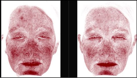 The Nude Method Nude Medical Aesthetics