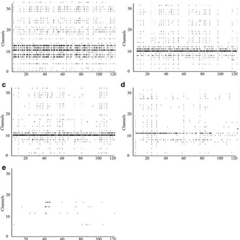 The Raster Plotting Of Neural Activity During Treatment With Different