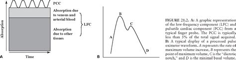 Pulse Oximeter Waveform Analysis