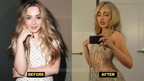 Sabrina Carpenter Plastic Surgery Speculations With Before After Pics