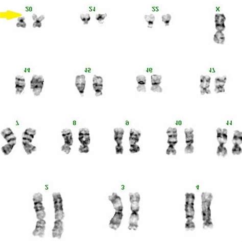 Bone Marrow Differential Count Download Table