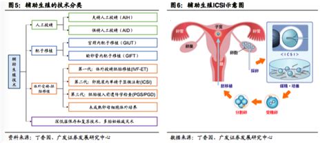 辅助生殖技术分类和icsi单精子注射的流程操作 优孕行