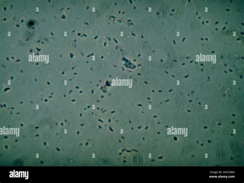 Mycobacterium Tuberculosis Light Micrograph Of The Rodlike Bacteria