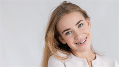 Orthodontist Braces Process At Brodie Eldershaw Blog