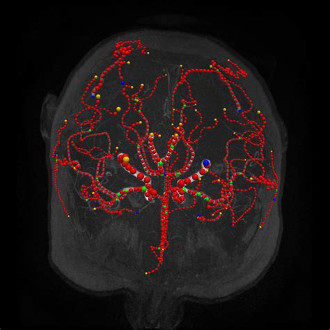 Project X Love Potion Disaster Rule 34 Advertisingsno