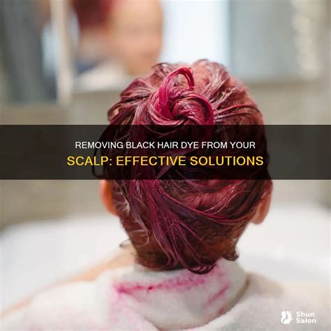 Removing Black Hair Dye From Your Scalp Effective Solutions Shunsalon