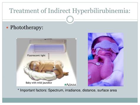 Ppt Neonatal Hyperbilirubinemia Powerpoint Presentation Free