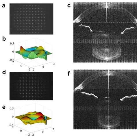 Pdf Measurement Of Wavefront Aberrations And Lens Deformation In The Accommodated Eye With