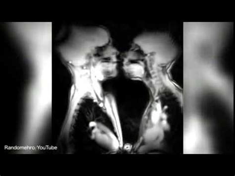 Mri Scans Take A Look At Internal Organs During Sex Youtube