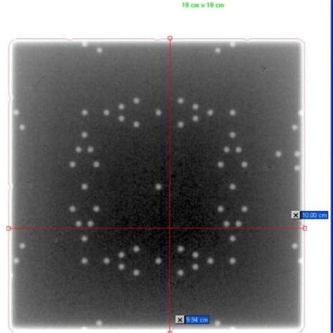 A Photograph Of The Light Radiation Congruence Qa Test Tool Download Scientific Diagram