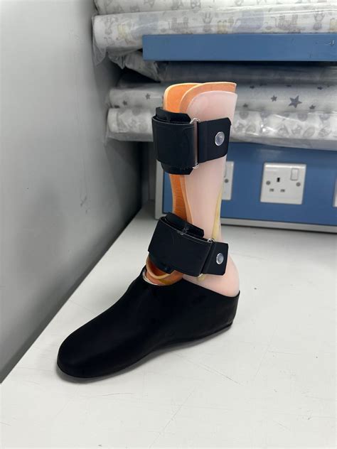 Yaqut Saad On Linkedin Prosthesis Amputation