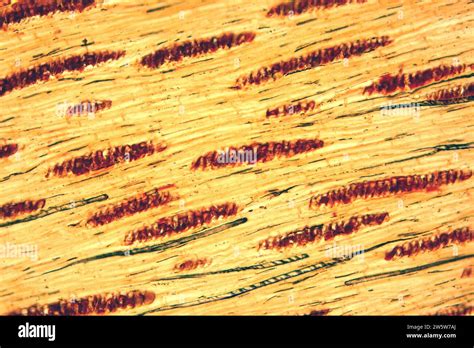 Xylem Parenchyma Or Woody Parenchyma Photomicrograph X100 At 10 Cm