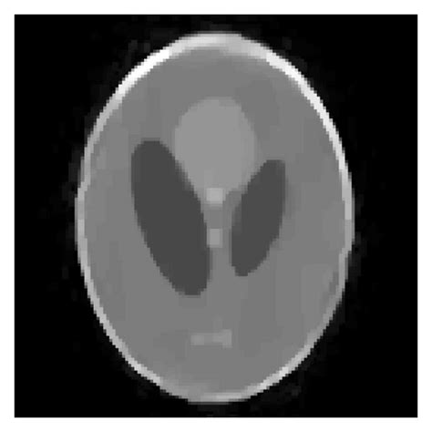 Scheme Of 2d Ultrasound Diffraction Tomography Illuminating The Object Download Scientific