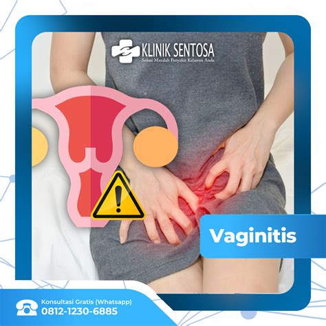 Seberapa Umum Penyakit Vaginitis Pada Wanita