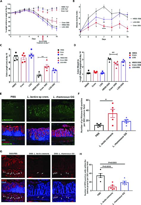 Lactococcus Lactis Subsp Cremoris Atcc 19257 Protects The Murine