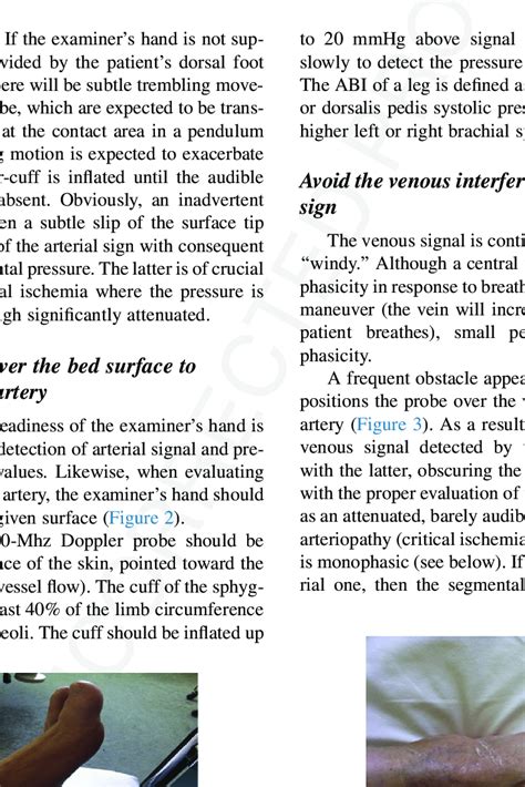 A Holding The Doppler Probe Away From The Dorsal Foot Surface Results Download Scientific
