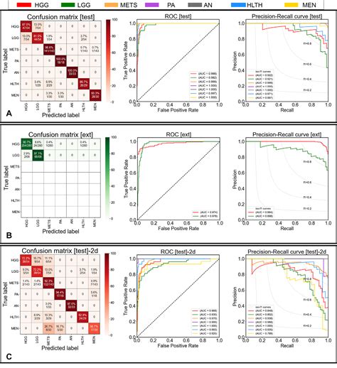 Figure 3 From Mri Based Identification And Classification Of Major Intracranial Tumor Types By