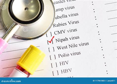 Nipah Virus Test Stock Image Image Of Immunology Form 117961883