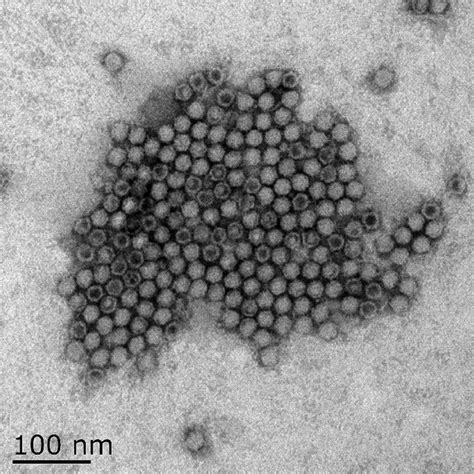 Electron Micrograph Of Recombinant Avian Adenoassociated Virus Download Scientific Diagram