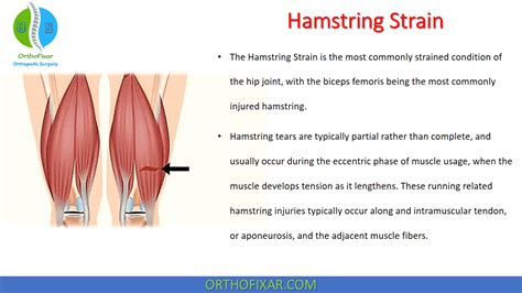Hamstring Tears Causes And Risk Factors