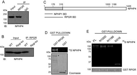 Rpgr Interacts With Nphp4 A Bovine Retinal Lysate Was Subjected To Ip